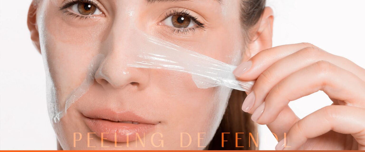 Peeling de Fenol – Dra Luciana Salgado
